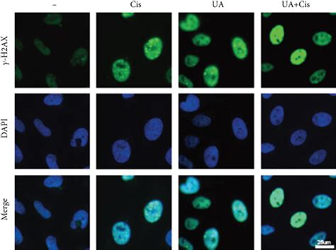 Combination Treatment With Ua And Cis Inhibited Os Cell Proliferation
