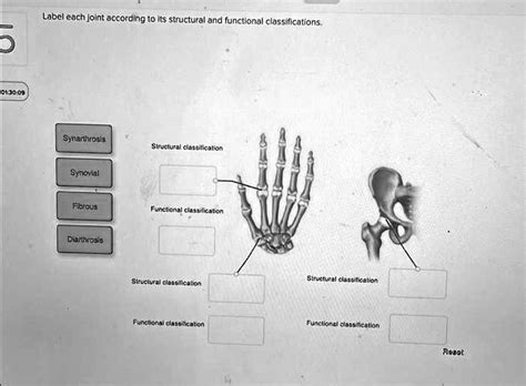 Solved Label Each Joint According To Its Structural And Functional Classifications 013009