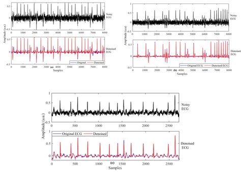 Figure 5 From A Robust Ecg Denoising Technique Using Variable Frequency Complex Demodulation