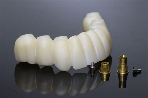 Full Anatomy Zirconia Bridge On IPD Interface Intellident