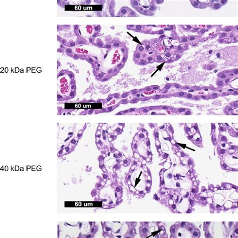 The Choroid Plexuses From A Saline Control Rat And Rats Administered