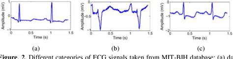 figure 1 from compressive sensing based continuous ecg monitoring and