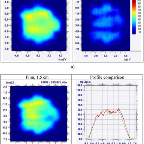 Dose Comparison Of Film Measurement And Tps Calculation For The Lamb Download Scientific