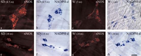 A H Four Sets Of Paired Micrographs Of The Myenteric Plexus Of The Rat