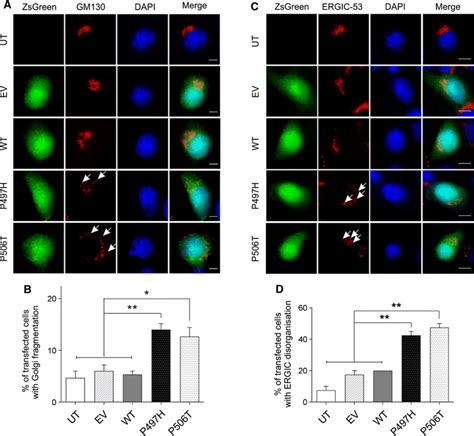 Alsftd Ubqln2 Mutants Induce Golgi Fragmentation And Ergic