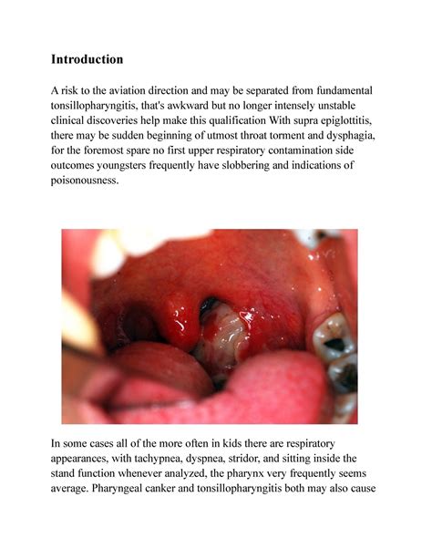 Tonsillopharyngitis Introduction A Risk To The Aviation Direction And May Be Separated From