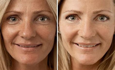 Купить «Крем невесты недорого Цены отзывы Закажите «Крем невесты сейчас