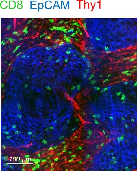 Ex Vivo Imaging Of Resident CD8 T Lymphocytes In Human Lung Tumor