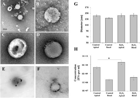 Figure 1 From Extracellular Vesicle Mediated Long Range Communication
