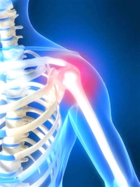 هل أنت مصاب بـتجمد الكتف إليك الأعراض أخبار السعودية صحيفة عكاظ