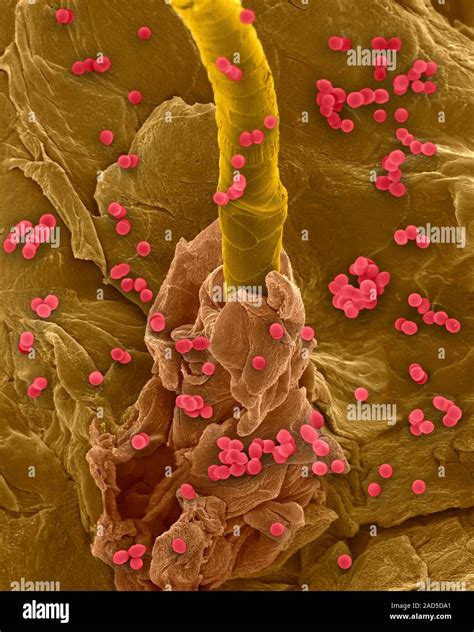 Coloured Scanning Electron Micrograph Sem Of Photocomposite Enterococcus Faecium On The