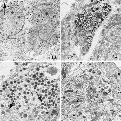 Chromaffin Cells Histology