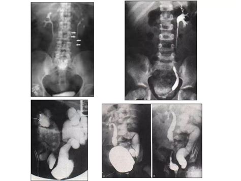 Basics Of Urology 1pptx