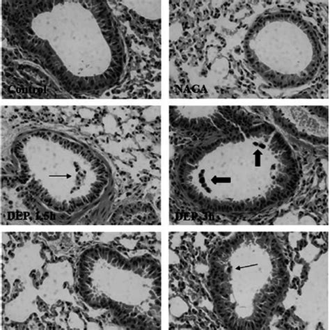 Representative Photomicrographs Of Hande Stained Lung Section Of Male