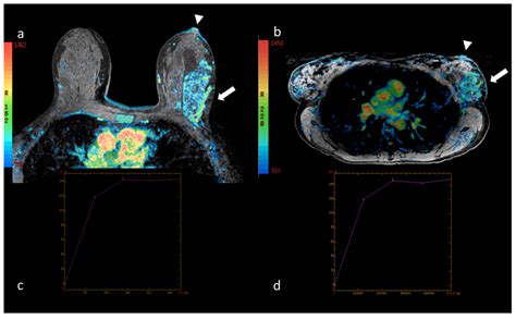 A Native Image Of The First Dynamic Sequence Performed In The Prone Download Scientific