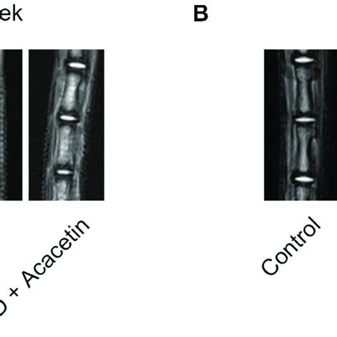 Mri Evaluation Of Rat Intervertebral Disc A T2 Weighted Mri Images Download Scientific