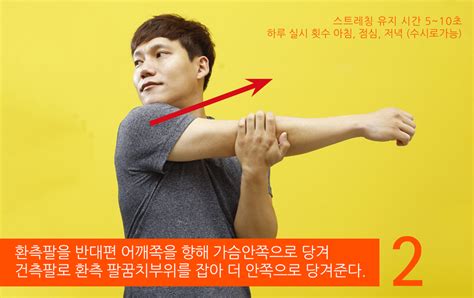 여수백병원 재활 운동 어깨관절 탈구 수술 3개월 후 네이버 블로그