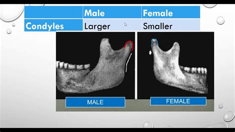 A Comparative Study Of Male And Female Mandibles Youtube