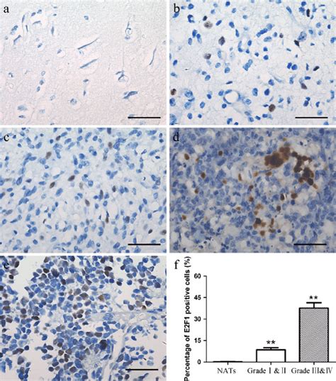 Photomicrographs Showing Representative Results Of Immunohistochemical