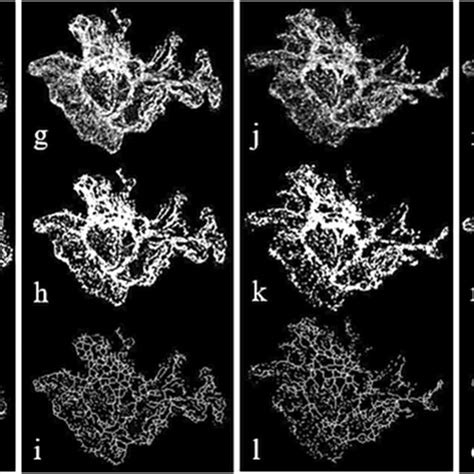 Analysis Of A Series Of Swept Source Optical Coherence Tomography