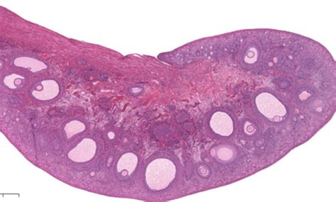 Chapter 27 The Reproductive System Part 2 Female Flashcards Quizlet