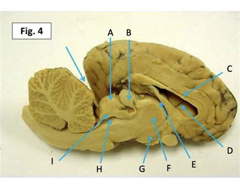 More Brain Structure Quiz
