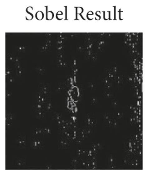 Edge Detection By Different Techniques A RGB Real Image B Gray