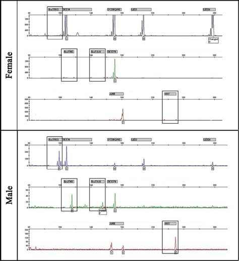 Characterization Of X And Y Linked Markers Results Of Microsatellite