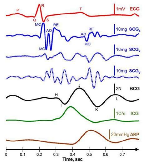 Simultaneously Acquired Lead Ii Of Ecg Three Dimension Scg Signal In