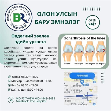 Hospital 🛡Хэрвээ таньд дараах шинж тэмдэг илэрч байвал Шатаар өгсөх уруудах үед өвдөг нь