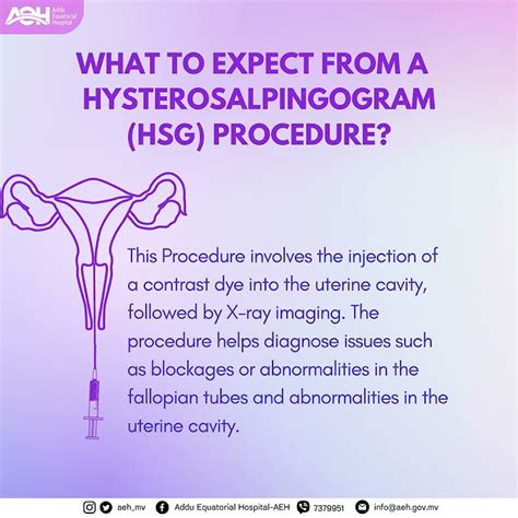 Hysterosalpingogram Procedure Youtube