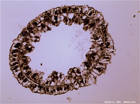 Hydra Cross Section Diagram Quizlet