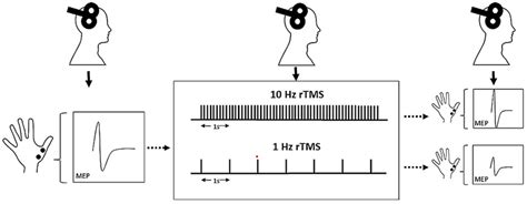 Basic Protocols And Main Effects Induced By Rtms Mep Motor Evoked Download Scientific Diagram