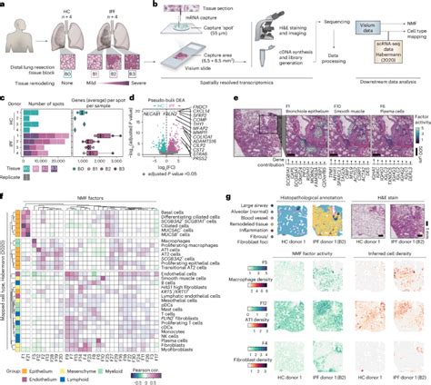 Mapping Spatially Resolved Transcriptomes In Human And Mouse Pulmonary Fibrosis Nature Genetics