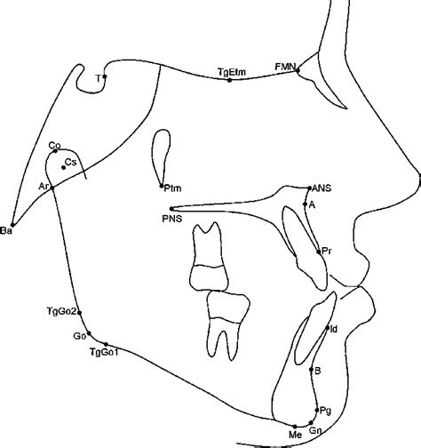 Landmarks Used For Morphometric Analysis Download Scientific Diagram