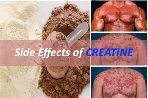 Benefits Of Creatine Side Effects Everything You Need To Know About It Efitnesshelp