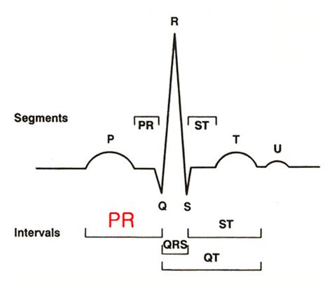 심전도 Elective Cardiography Ecg 네이버 블로그