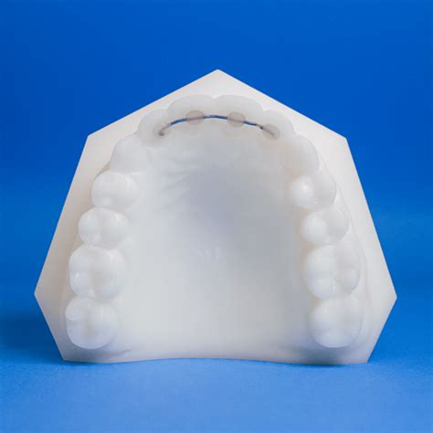 Composite Fixed Lingual Retainers Specialty Appliances