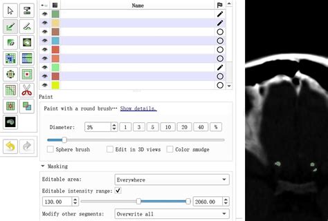 Why Did The Segment Created By Threshold Masking Contain Voxels Beyond The Threshold Support