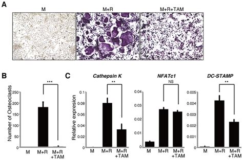 Tamoxifen Inhibits Osteoclast Differentiation In Vitro Osteoclast
