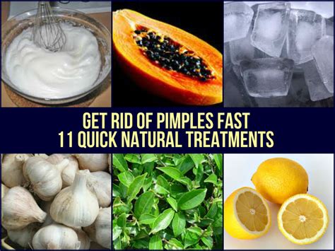 Natural Ways To Get Rid Of Pimples Fast