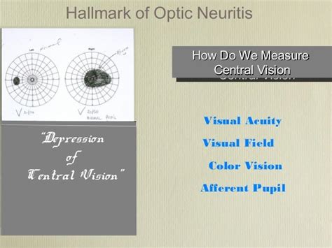 Optic Neuritis