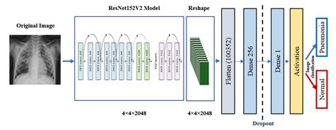 Chest X Rays Pneumonia Detection Using Convolutional