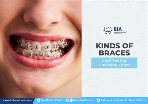 The Best Dental Clinic In Bali Bali Implant Aesthetic Bia Dental Center
