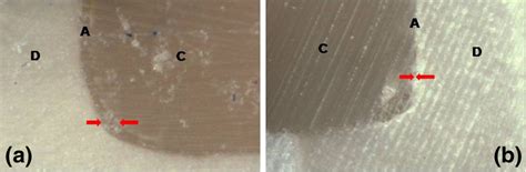 Stereoscope Microscope Images In The Restorations Of Silorane A And