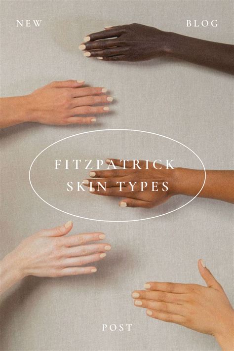 Fitzpatrick Skin Type Post Hands Of All Skin Colors Scale Skin Grasp