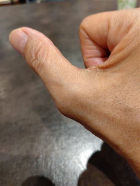 指の痛み 日々穏やかに暮らしたい