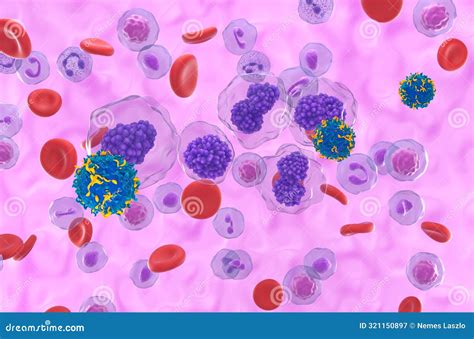 Car T Cell Therapy In Plasma Cell Leukemia Pcl Isometric View 3d