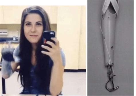 Asstechfin Week 1 Types Of Lower Limb Amputation Flashcards Quizlet