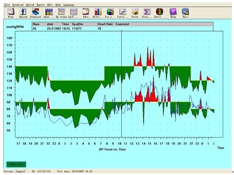 Nibp Monitor Patient Monitor High Quality Nibp Monitor Patient